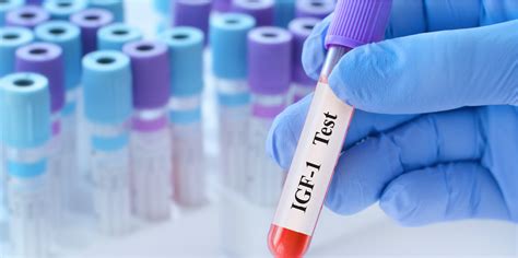 Acromegaly Diagnostics Mims Indonesia