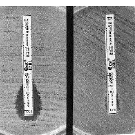 Application Of Esbl Detecting Etest In The E Coli Strains Producing