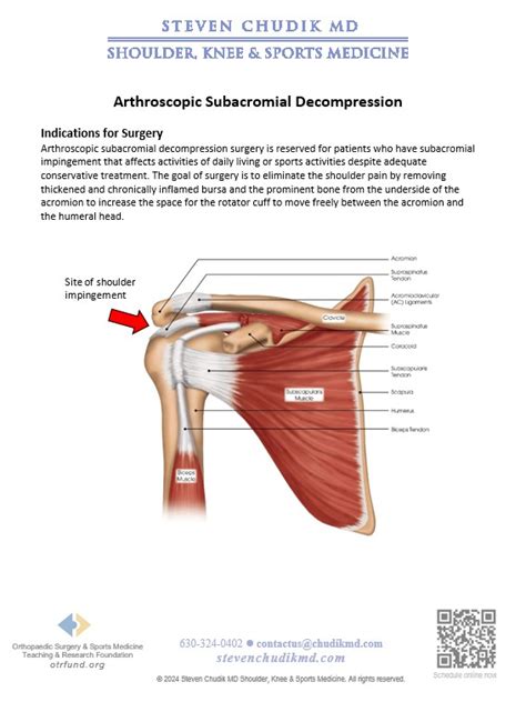 Subacromial Decompression Steven Chudik Md