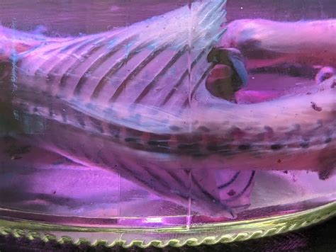 Need Help Identifying Muscle Ranatomy