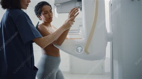 Nurse Showing Patient Mammography Screening Procedure Stock Video
