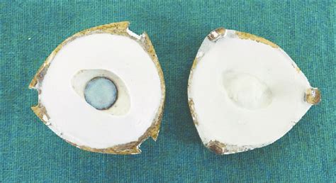 Prosthesis Invested And Dewaxed In An Ocular Flask Download