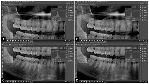 Diagnostics Free Full Text Age Estimation In Brazilian Adults Using