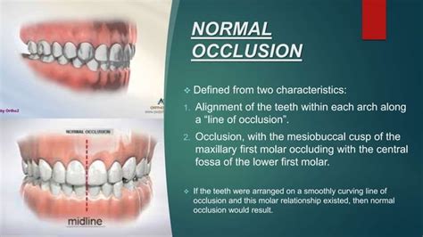Dentistry Pptx On Topic Of Normal Occlusion Ppt