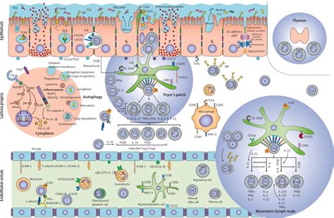 Crohns Disease Definition Etiology Pathogenesis Treatment And Mcqs For For Neet Gpat Csir