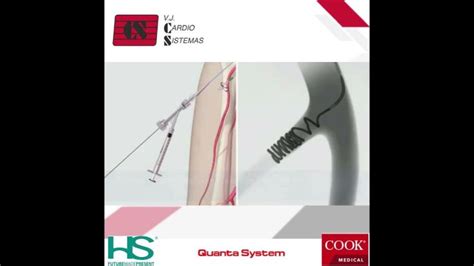 Which Medical Device Ltd On Linkedin Retracta® Detachable Embolization