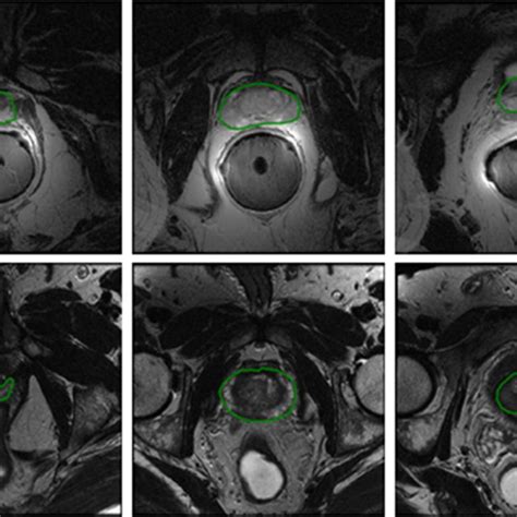 The Different Pattern In Prostate Download Scientific Diagram
