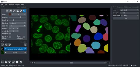 Napari Segment Blobs And Things With Membranes · Pypi