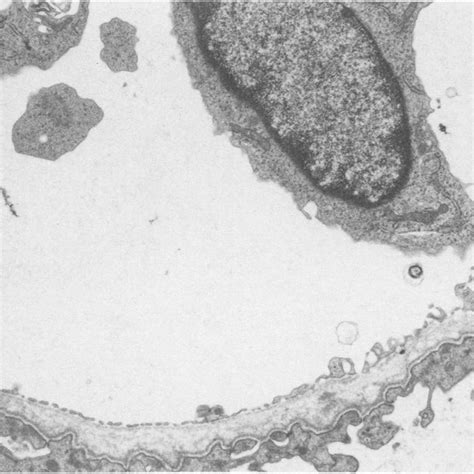 A Scanning Electron Microscopy Sem Of Isolated Cellular Glomerulus