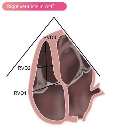 Standard Transthoracic Echocardiogram Complete Imaging Protocol Ecg And Echo
