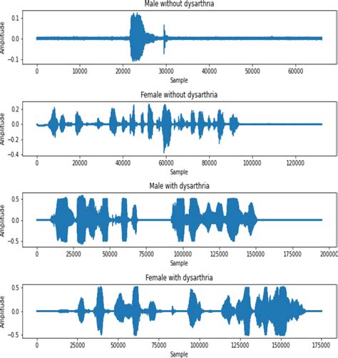 Enhancing Dysarthria Severity Classification Efficient Audio Based