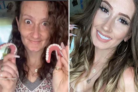 Toothless Tiktok Sensation Proudly Flaunts Her Dentures The Citizen