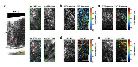 Noninvasive Label Free Optical Method Visualizes Deep Cellular Brain