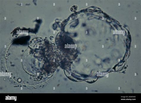 Light Micrograph Showing A Hatching Blastocyst A Six Days Old Human