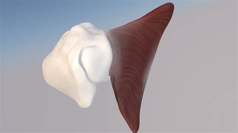 3d Model Of Normal Shoulder Capsule Anatomy And Distentionof The