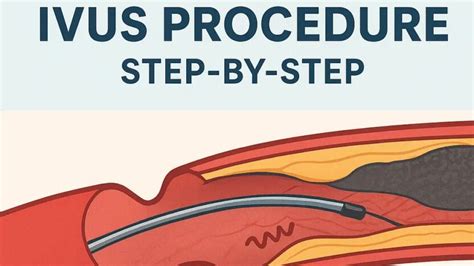 Cardiac Catheterization Lab Cath Lab Procedure Types Indications And Cost Quickhealthlife