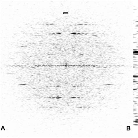 Electron Micrograph And Computed Diffraction Pattern A Electron