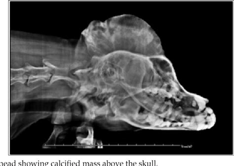 Figure 1 From Subcutaneous Extraskeletal Osteosarcoma Of The Head In A