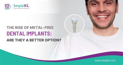 The Rise Of Metal Free Dental Implants Are They A Better Option