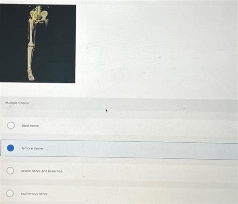 Solved Multiple Choice Tibial Nerve Femoral Nerve Sciatic