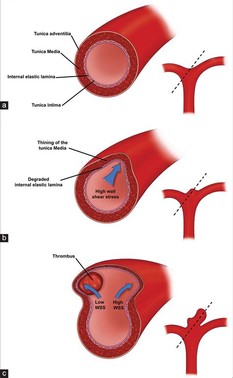 Surgical Neurology International
