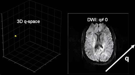 Understanding Diffusion Mr Imaging Techniques From Scalar Diffusion