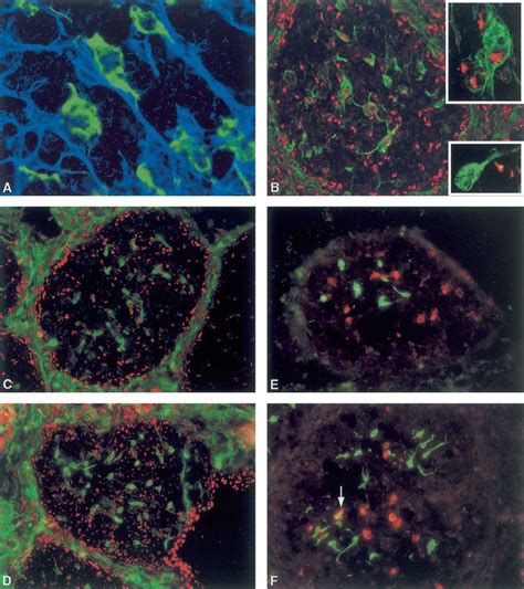 A F Development Of Quail Embryo Bursae After 18 Days Of Incubation A Download Scientific