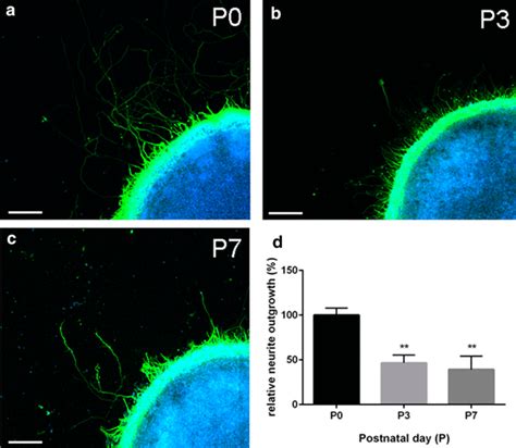 Comparison Of Neurite Outgrowth From Mouse Retinal Explants At