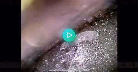 Toilet Vent Blockage Album On Imgur