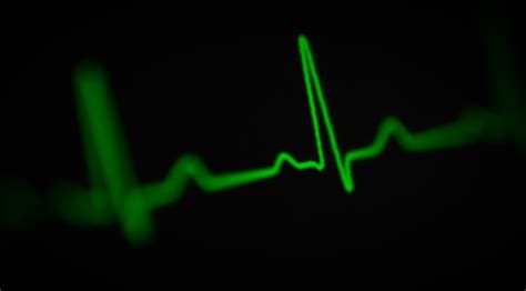Ecg Vs Ekg Whats The Difference This Vs That