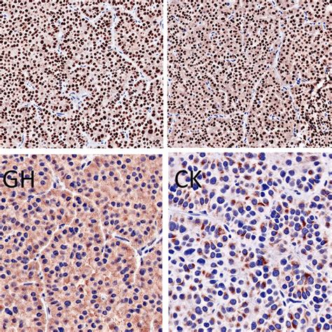 Immunohistochemical Features Of A Multilineage Pitnet Expressing Pit1