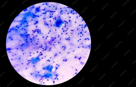 Cocci Bacteria Under Microscope