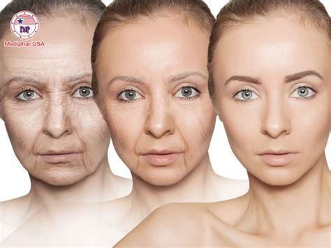 Mắt Trũng Là Gì Nguyên Nhân Dấu Hiệu Và Cách điều Trị