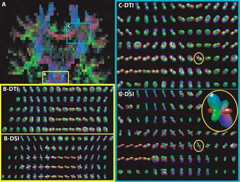 Understanding Diffusion Mr Imaging Techniques From Scalar Diffusion