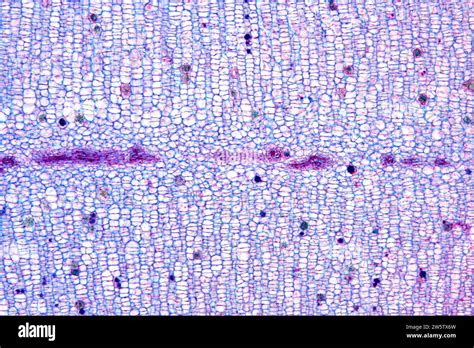 Meristematic Tissue Under Microscope