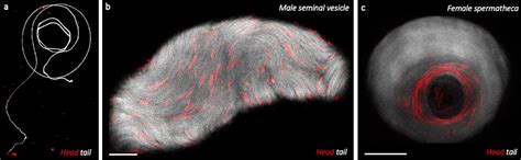Computational Biology Goes Under The Microscope