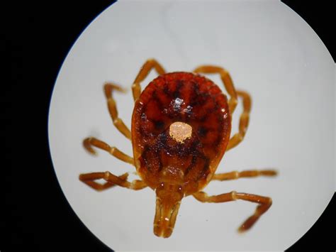 Tick Under Microscope