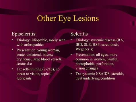 Conjunctivitis Ppt