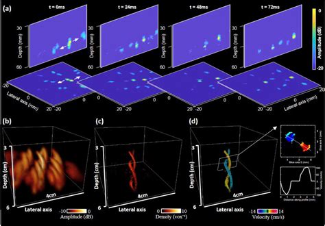 Ultrasound Localization Microscopy Ulm Of A Tube Using The 4λ Matrix Download Scientific