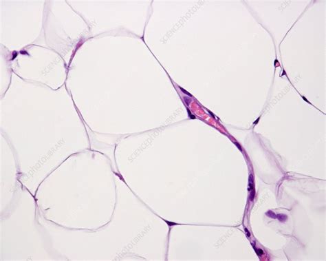 Adipose Connective Tissue Capillary