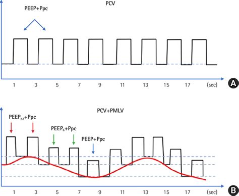 Schematic Representation Of Pressure Vs Time Curve Scheme When