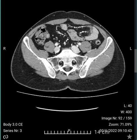 821 Best Ct Scan Images On Pholder Interestingasfuck Oddlyterrifying