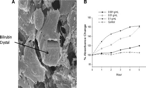 Scanning Electron Micrograph Showing A Bilirubin Crystal With Arachnoid