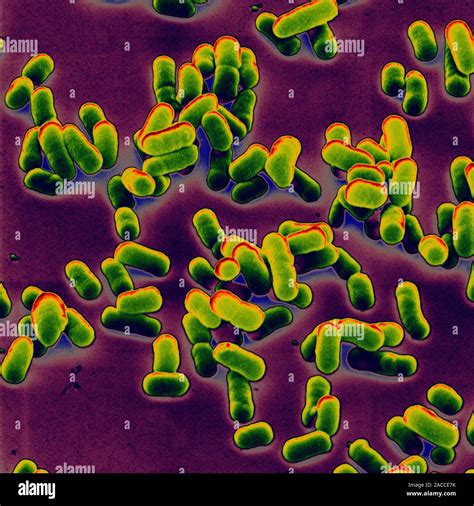 Yersinia Pestis Coloured Scanning Electron Micrograph Sem Of