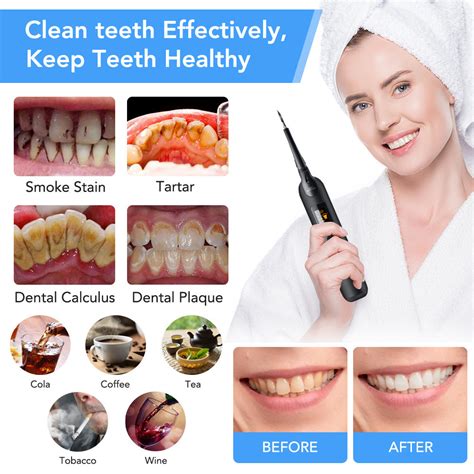 High Quality Piston Pump Male Toothpaste Razor Blade Dental Material
