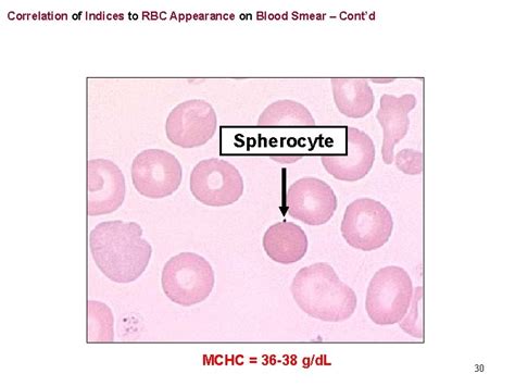Lecture 8 Hemoglobin Hematocrit Rbc Indices Keohane Em
