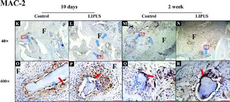 Immunohistochemical Staining For Mac 2 In The Control And Lipus Group Download Scientific