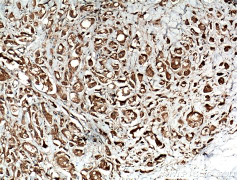 Lc3a Specific Antibody 18722 1 Ap Proteintech