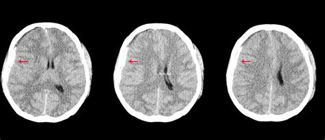 Catastrophic Lawyer Orlando Newsome Law
