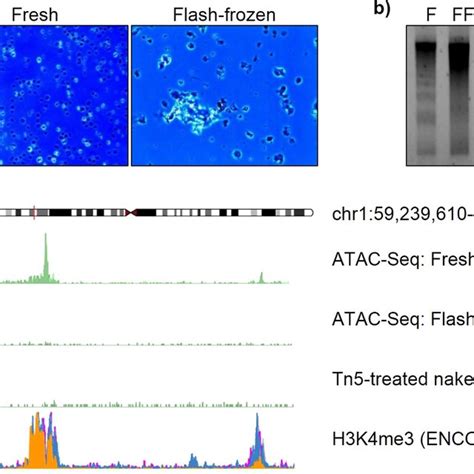 Pdf Cell Freezing Protocol Suitable For Atac Seq On Motor Neurons